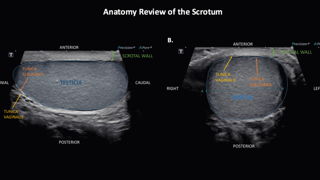 Epidídimo: almacenamiento y maduración de espermatozoides en hombres